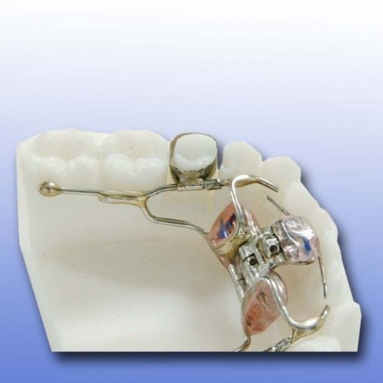 Distal-Jet - Los Ortodonzia