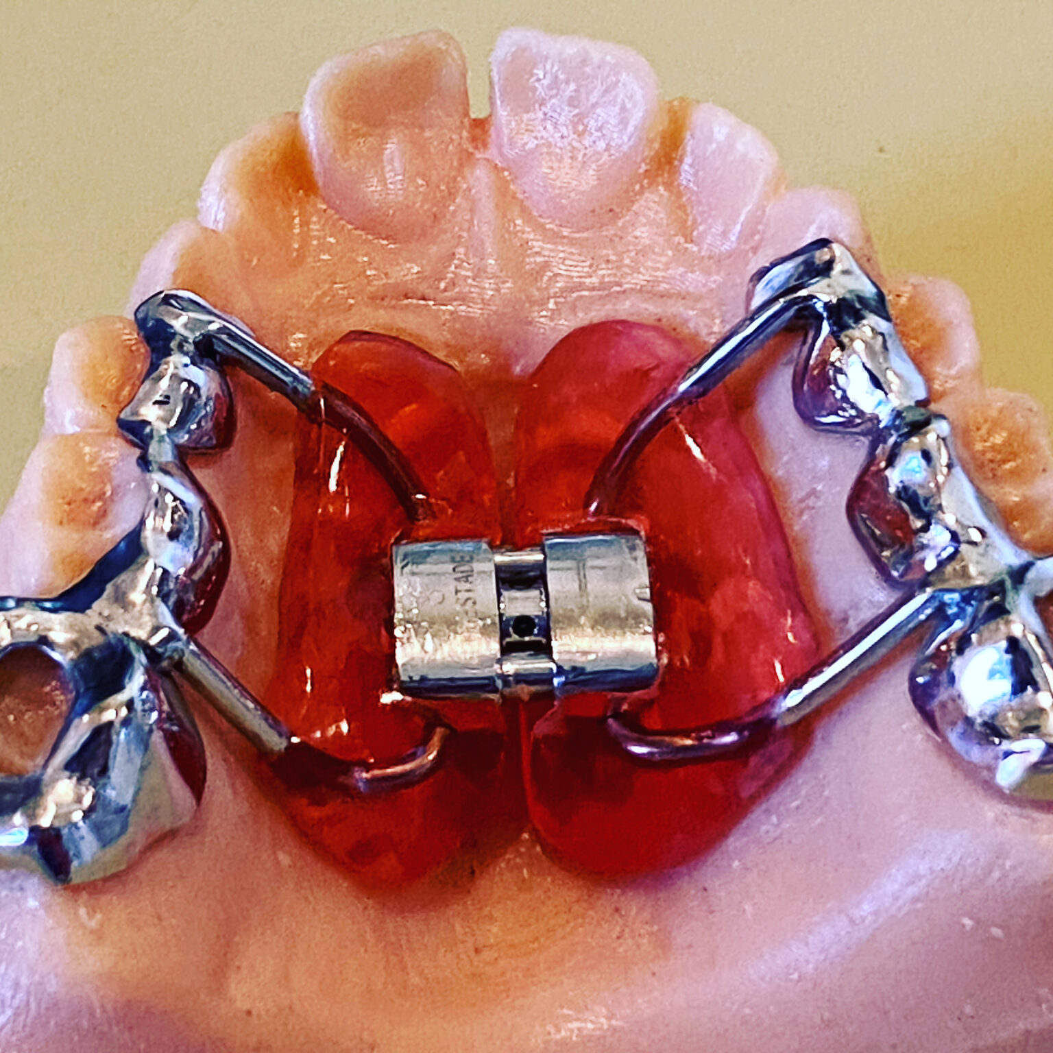 Transforce di Clarke trasverse - Los Ortodonzia