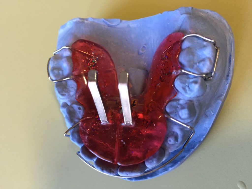 Sander - Los Ortodonzia