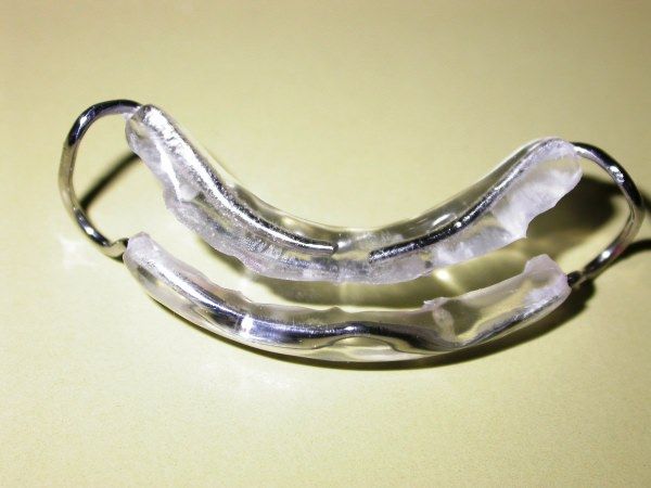 Spring retainer anteriore - Los Ortodonzia