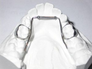 Transforce di Clarke trasverse - Los Ortodonzia